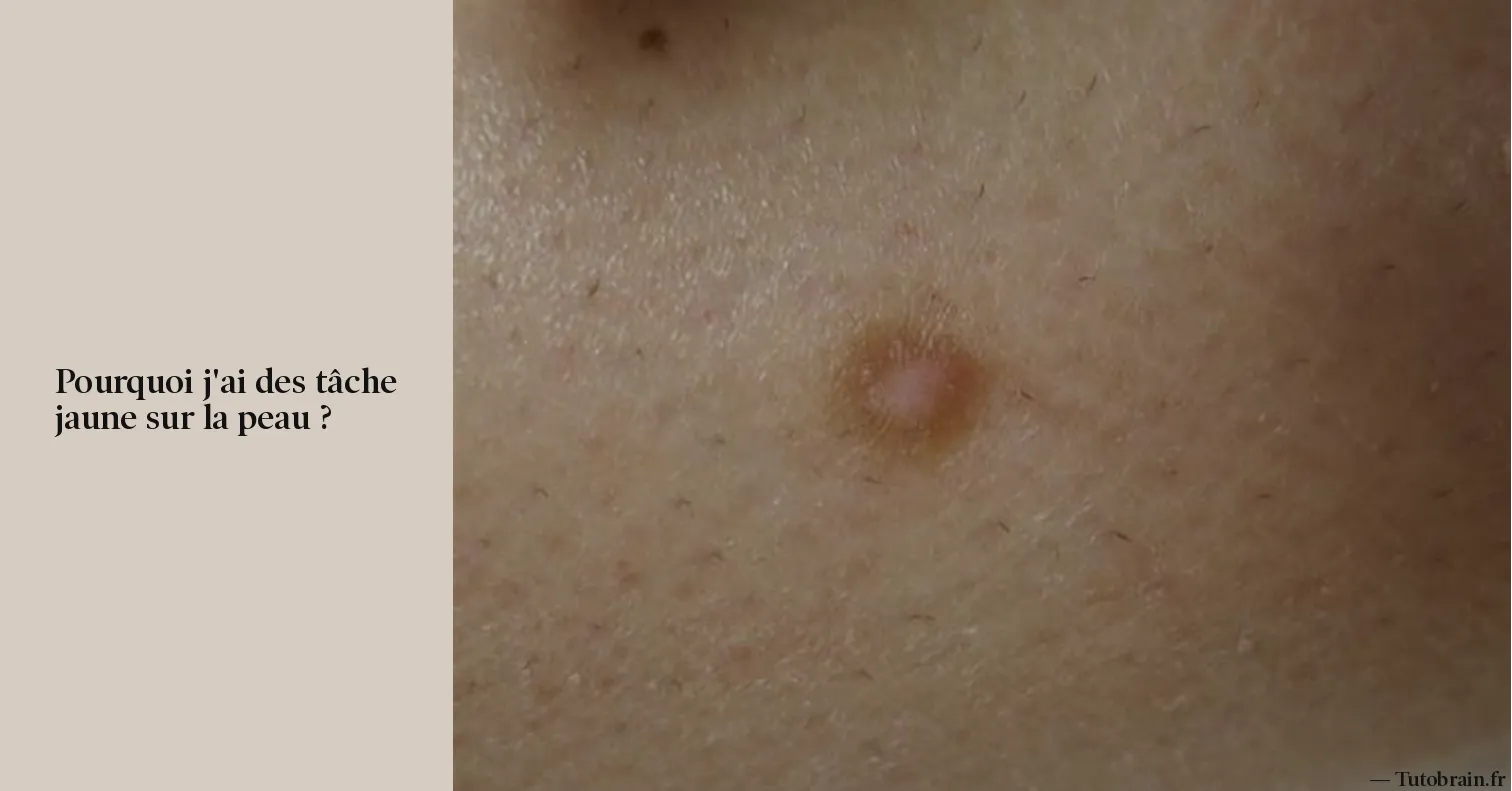 Pourquoi ai-je des tâches jaunes sur la peau ? Découvrez les causes et ...